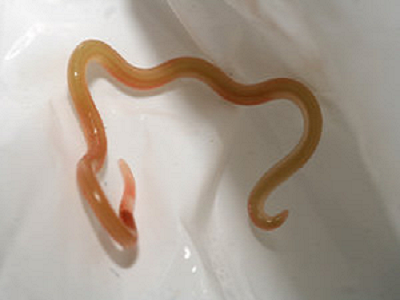 What does a ROUNDWORM study teach us about the aging process? - Ideal ...